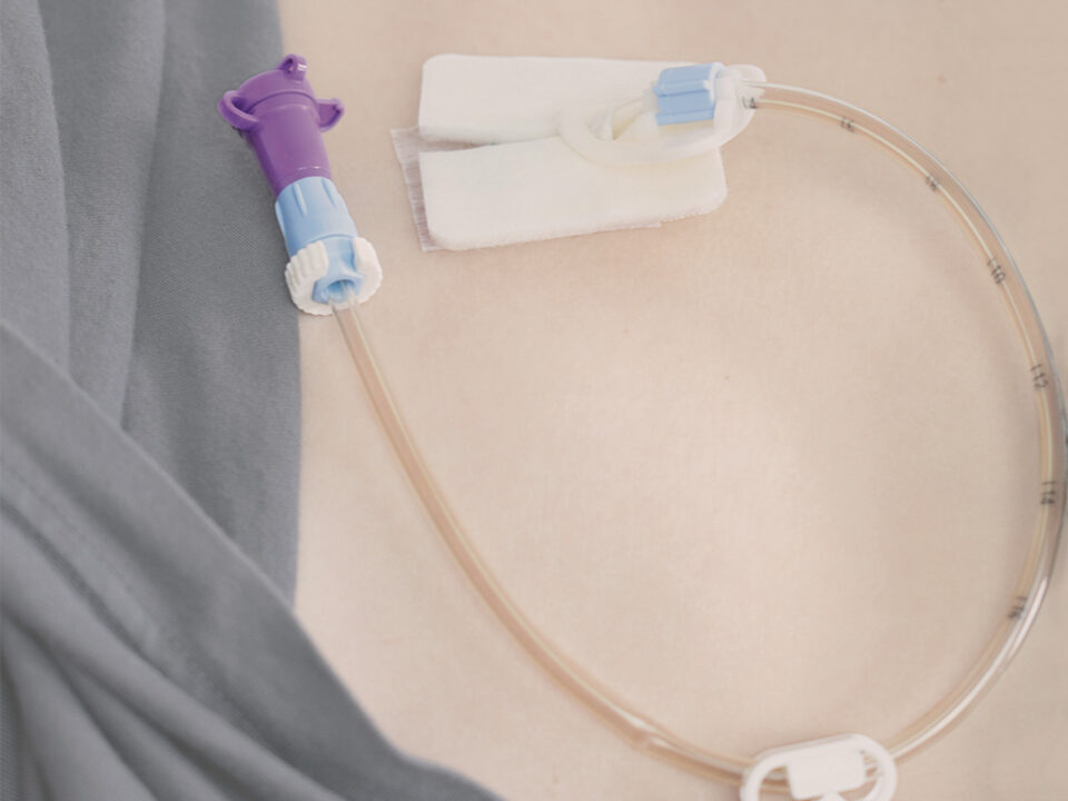 Bei Enteralen Ernährung für Betroffene und Angehörige